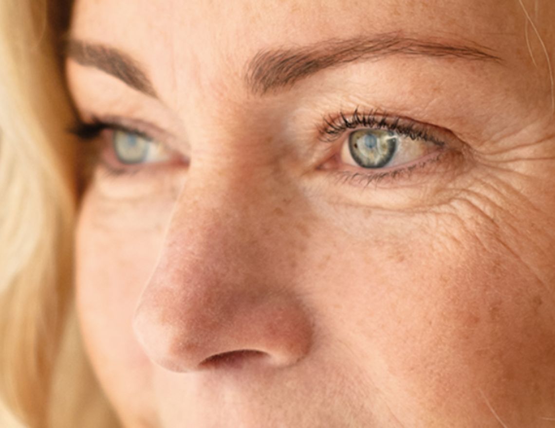 Rides sous les yeux : les astuces pour les atténuer - Dr Pierre Ricaud